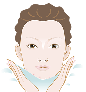 How to remove pimples? 3 effective steps with video here