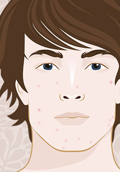 Itchy face skin causes and treatments